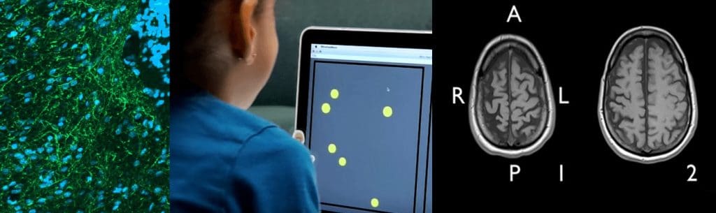 Research | Psychological & Brain Sciences | Johns Hopkins University